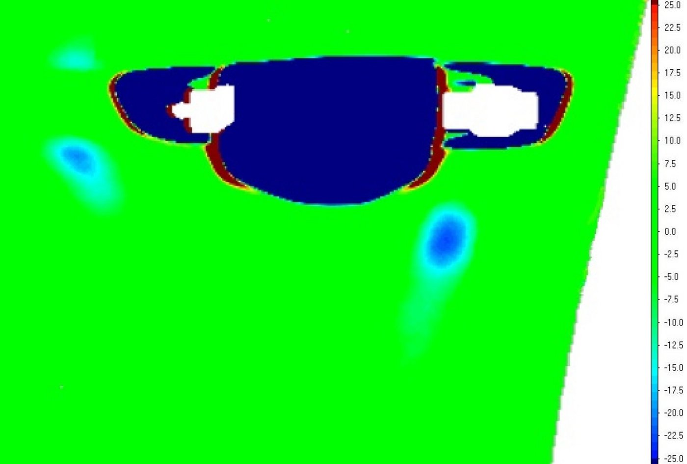 Technologies | INB Vision